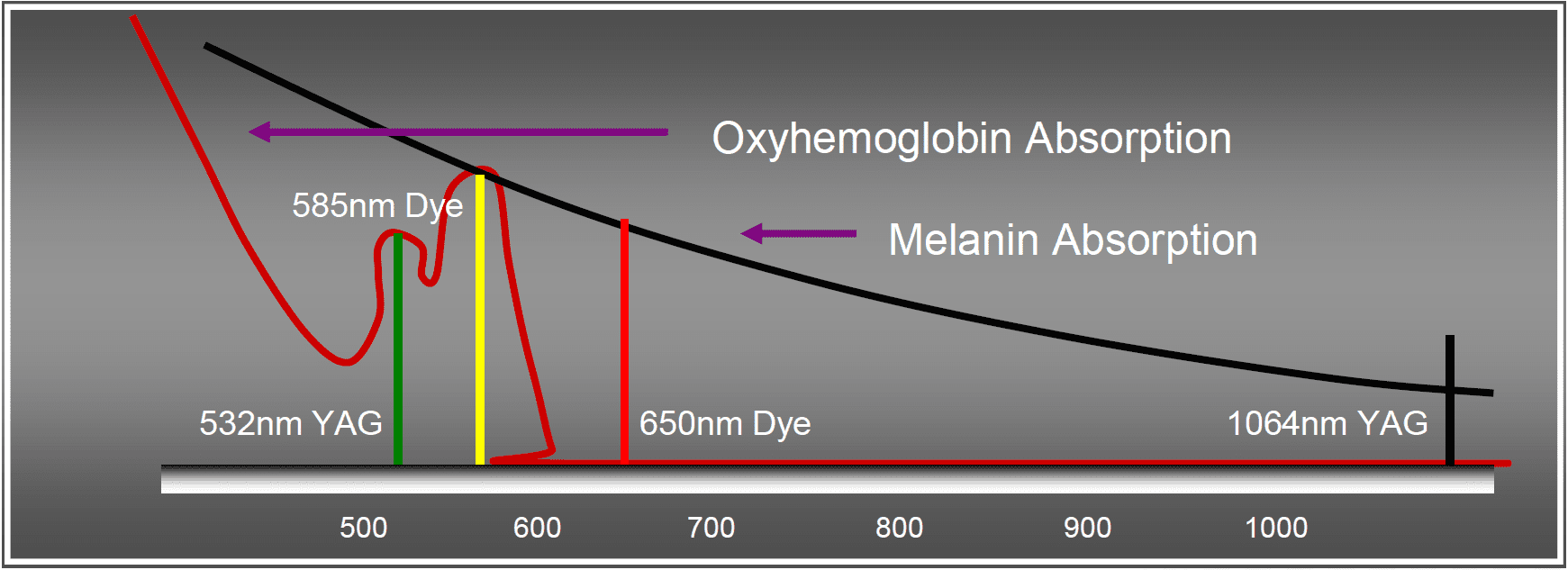Revlite SI - Q-Switched laser for tattoo, skin, and pigment | Treats ...