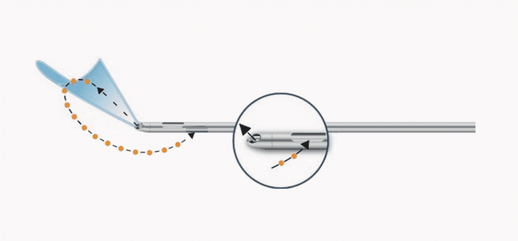body-jet® - Liposuction and lipotransfer | Human Med AG
