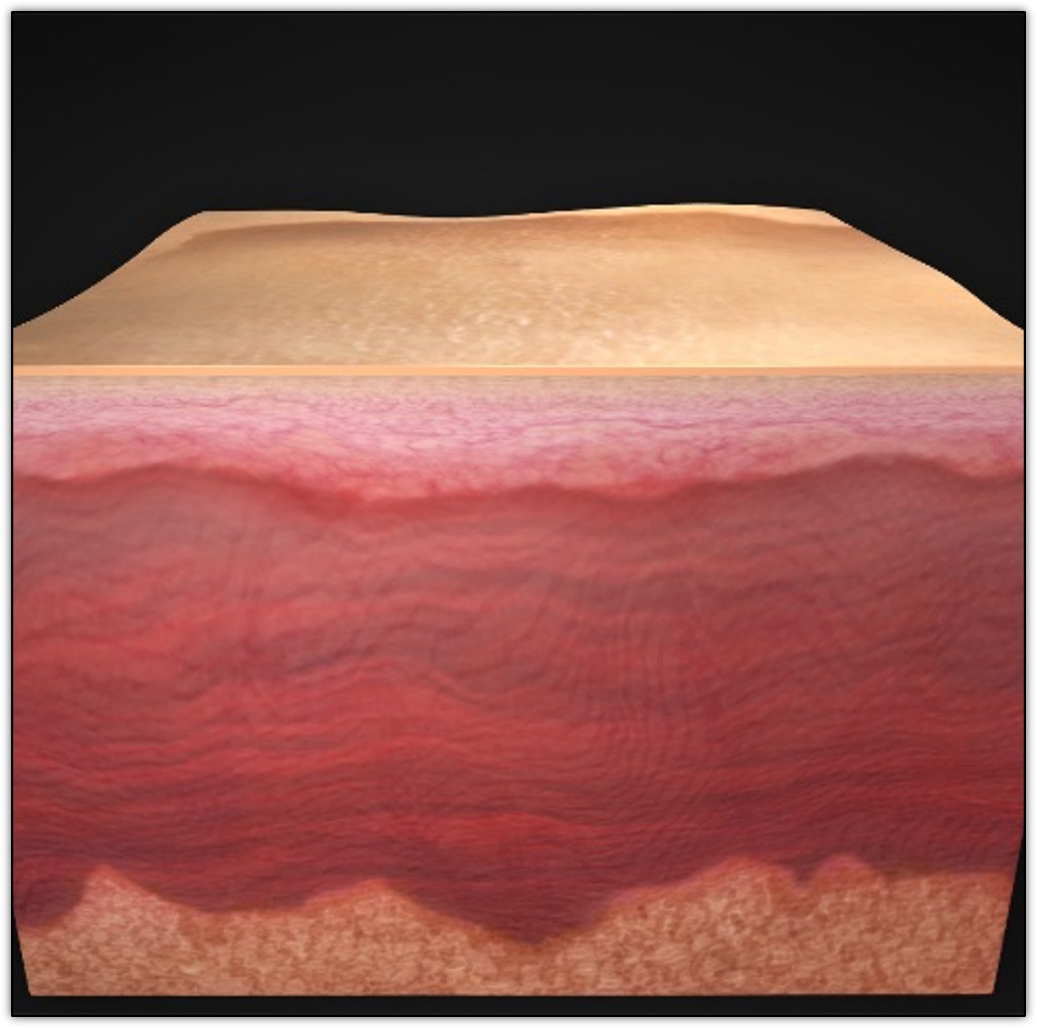 PICOSURE® PRO - The World’s 1st 755nm Picosecond Laser