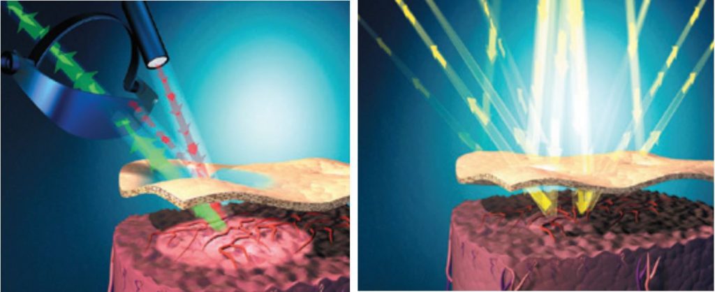 Syris v900L - See Below the Skin’s Surface